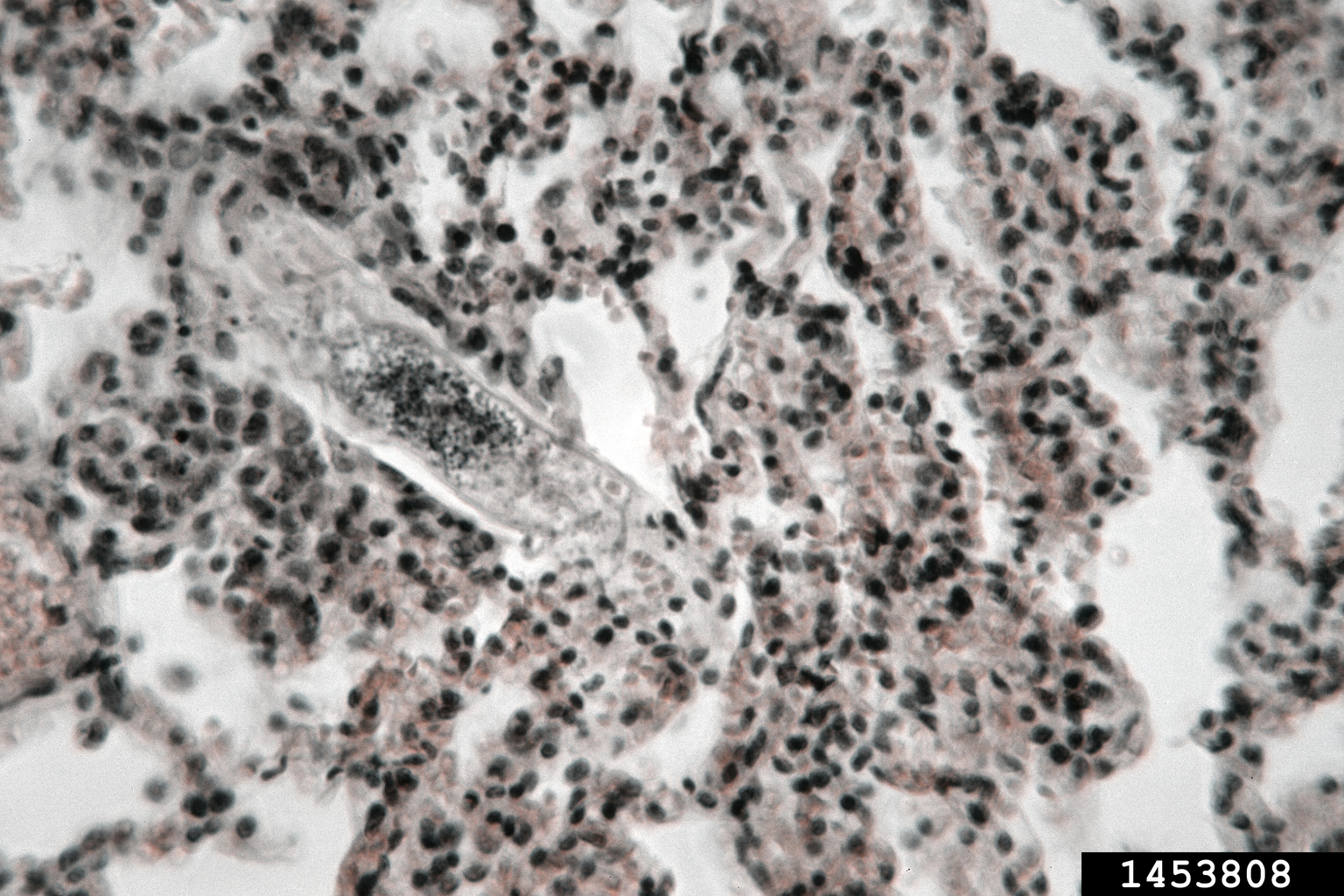 dog follicle mite (Demodex canis Leydig)