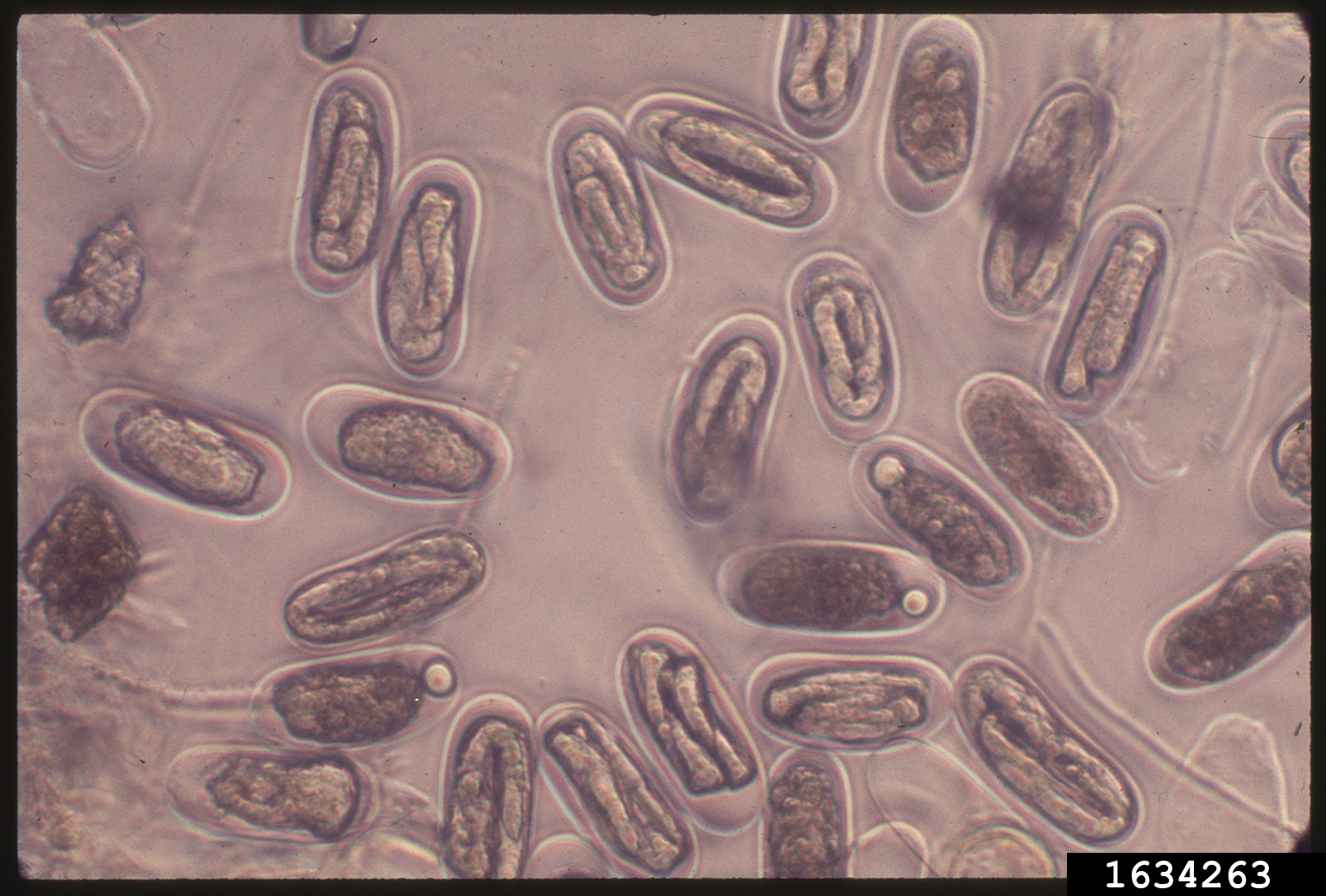 Southern root-knot nematode (Meloidogyne incognita (Kofoid & White))