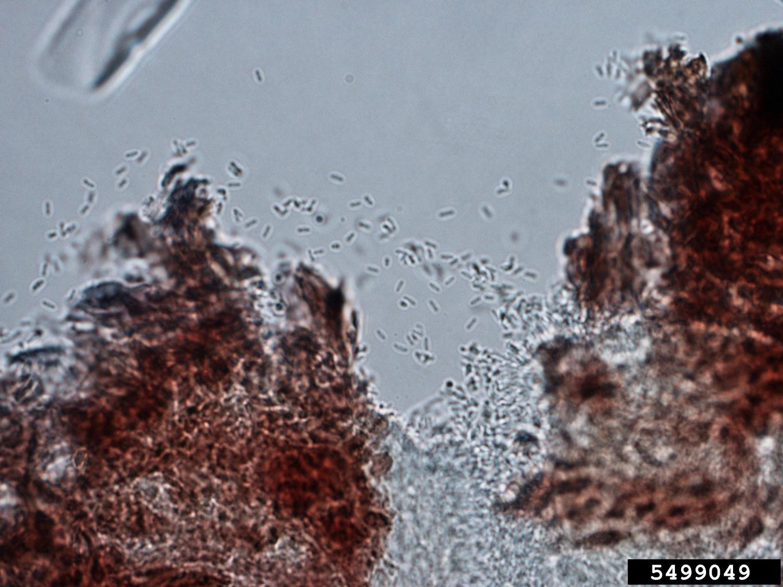 Phoma blights (Genus Phoma Sacc.)