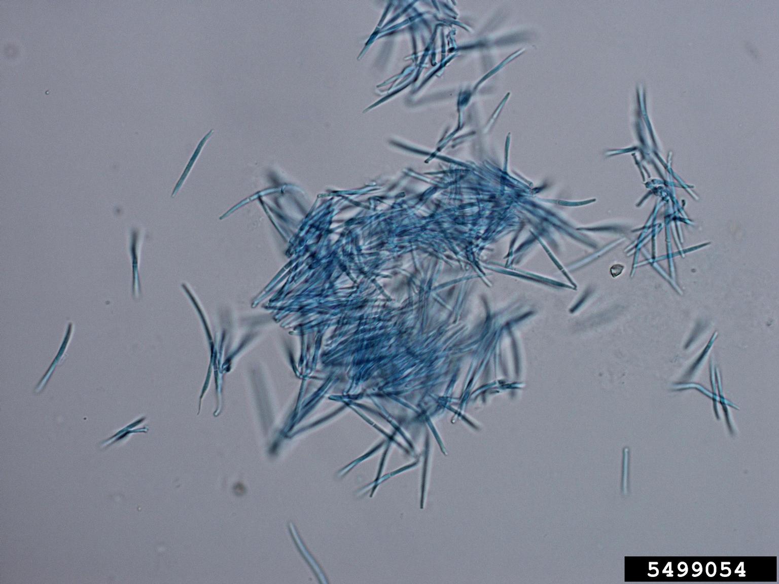 Septoria leaf spot (Septoria apiicola)