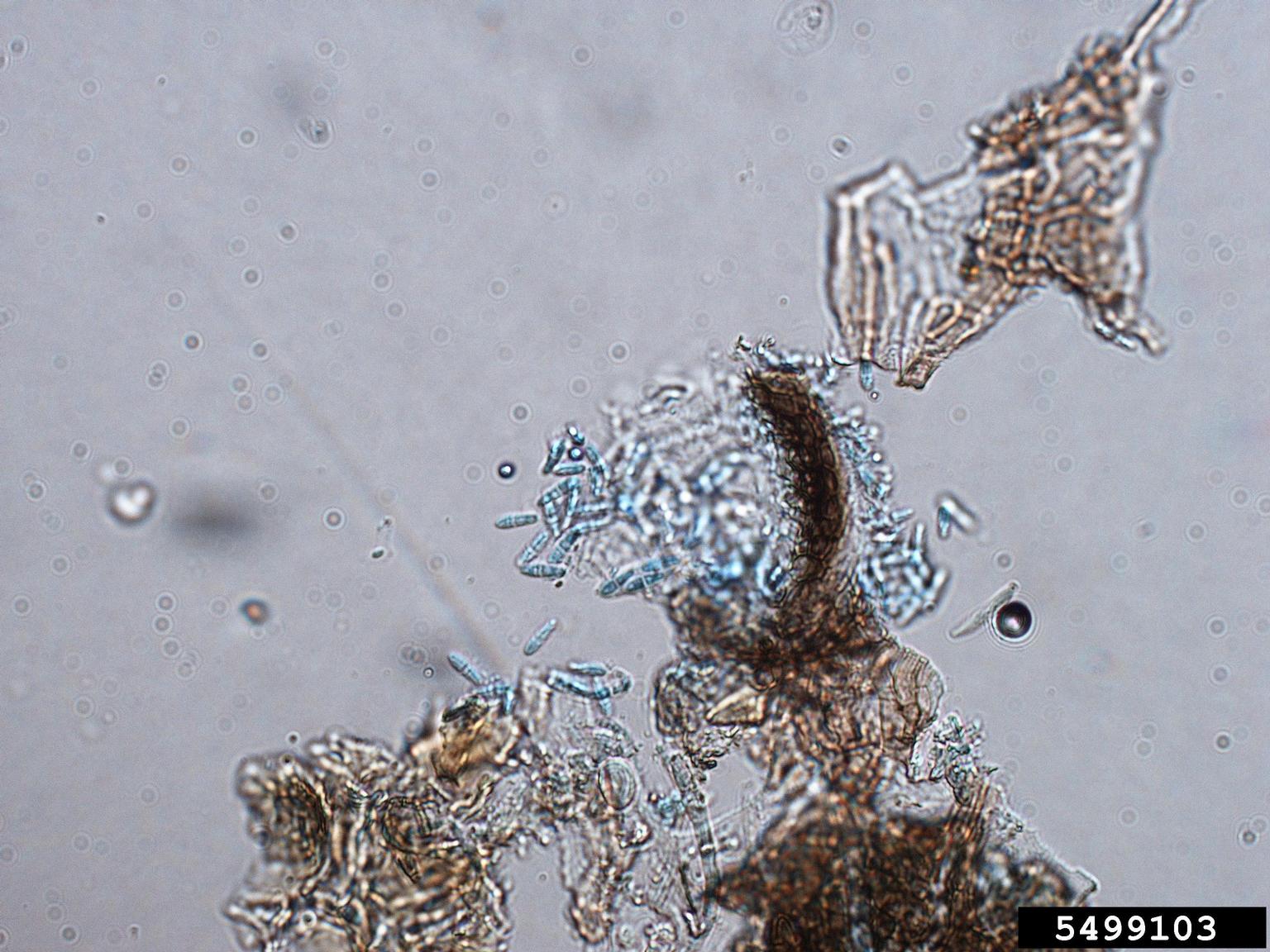 Mycosphaerella fungi (Genus Mycosphaerella Johanson)