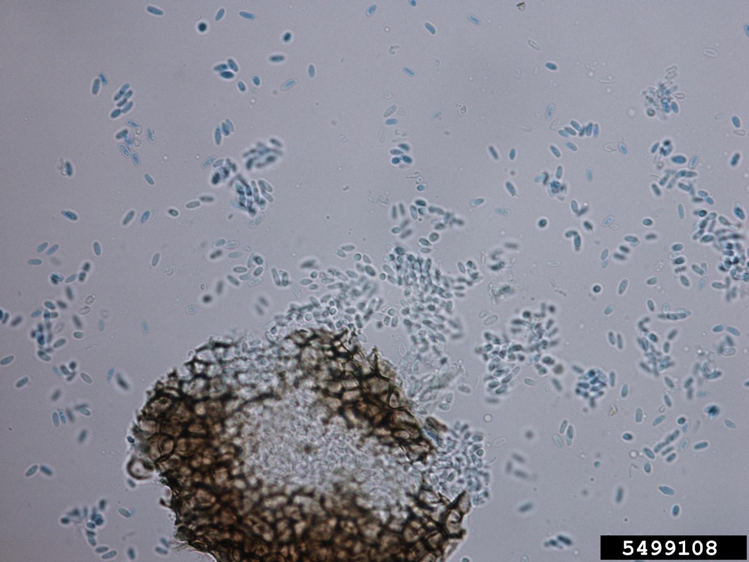 Phoma blights (Genus Phoma Sacc.)