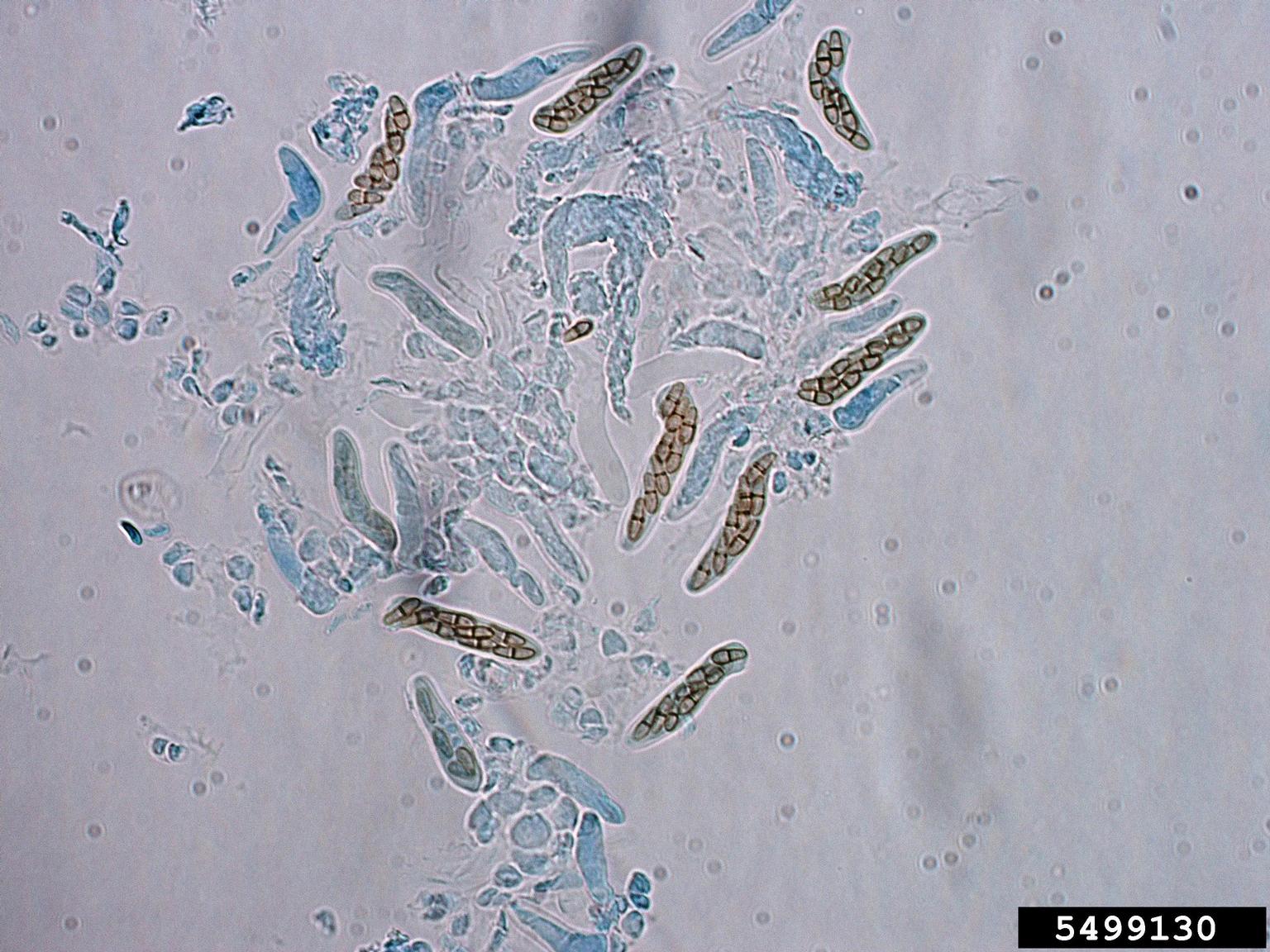 Mycosphaerella fungi (Genus Mycosphaerella Johanson)