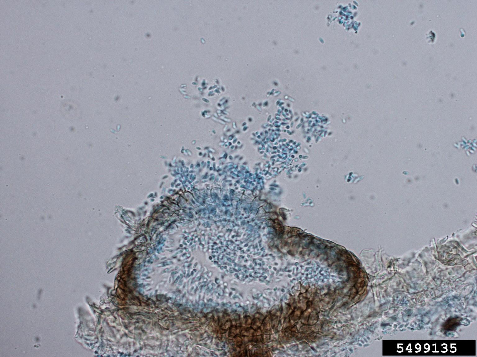 Phoma blights (Genus Phoma Sacc.)