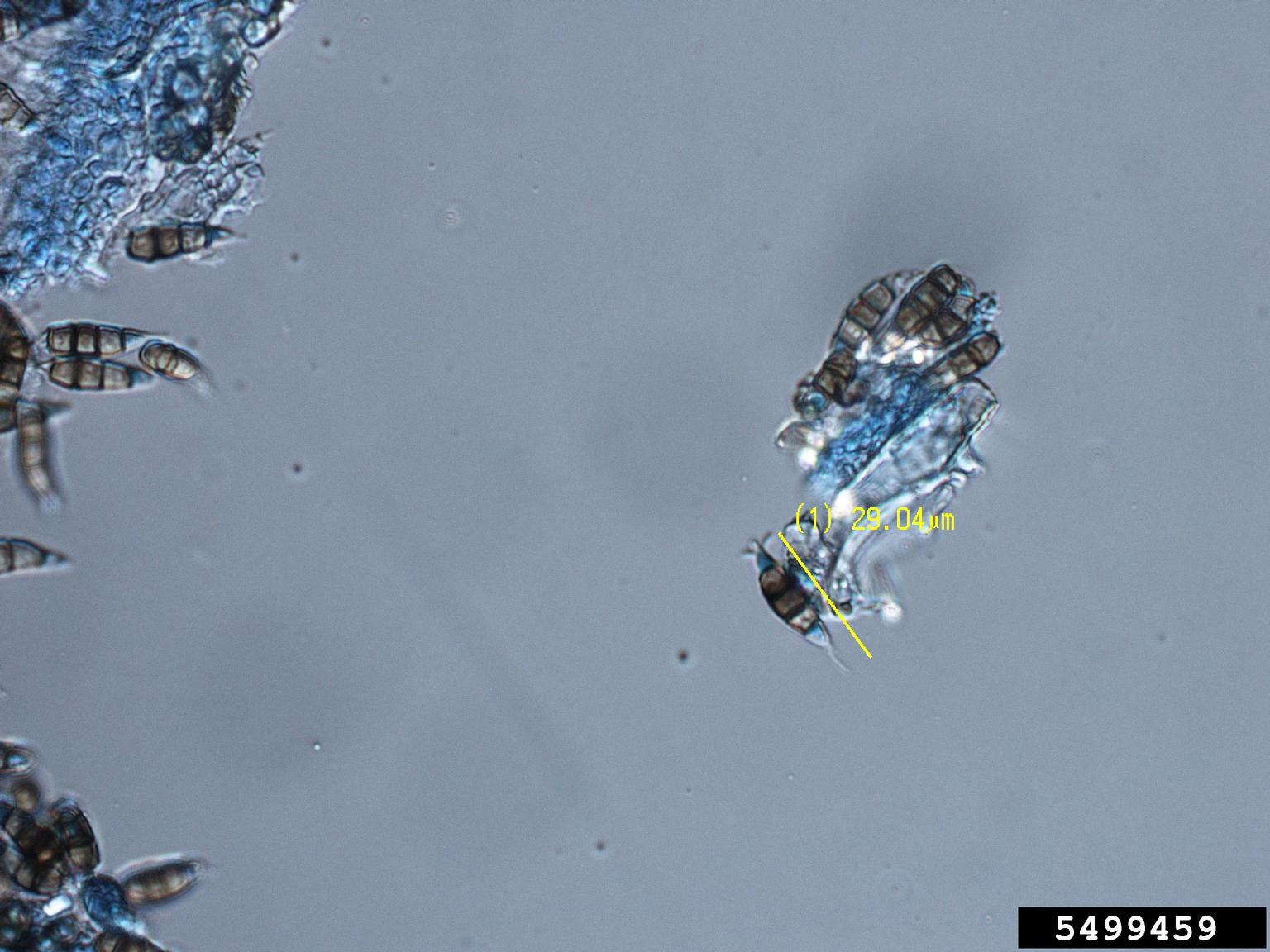 Pestalotiopsis leaf spot (Pestalotiopsis versicolor (Speg.) Steyaert)