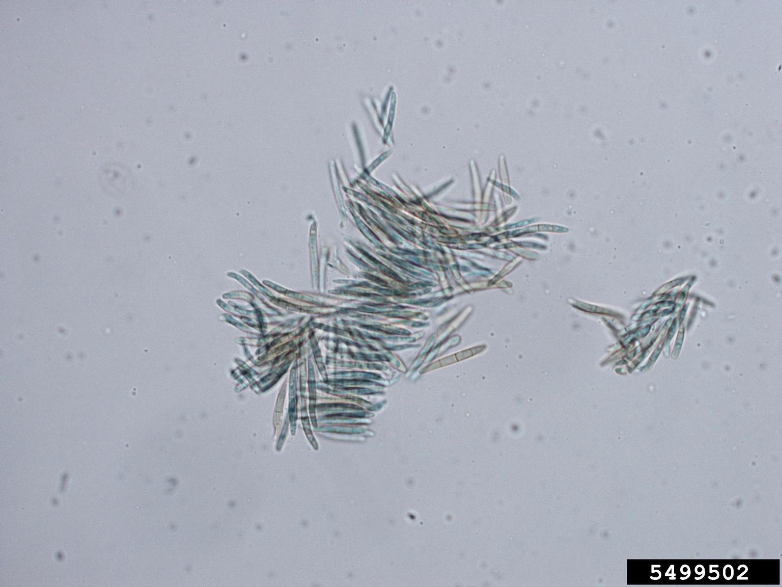 Phaeosphaeria fungi (Genus Phaeoseptoria Speg.)