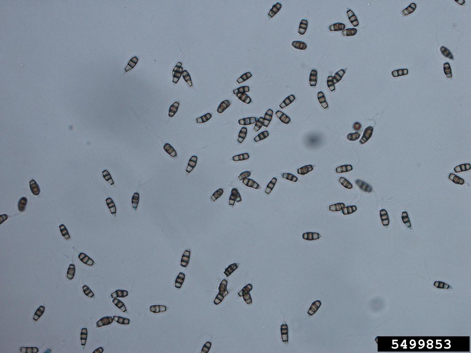 Pestalotiopsis leaf spot (Genus Pestalotiopsis R. L. Steyaert)