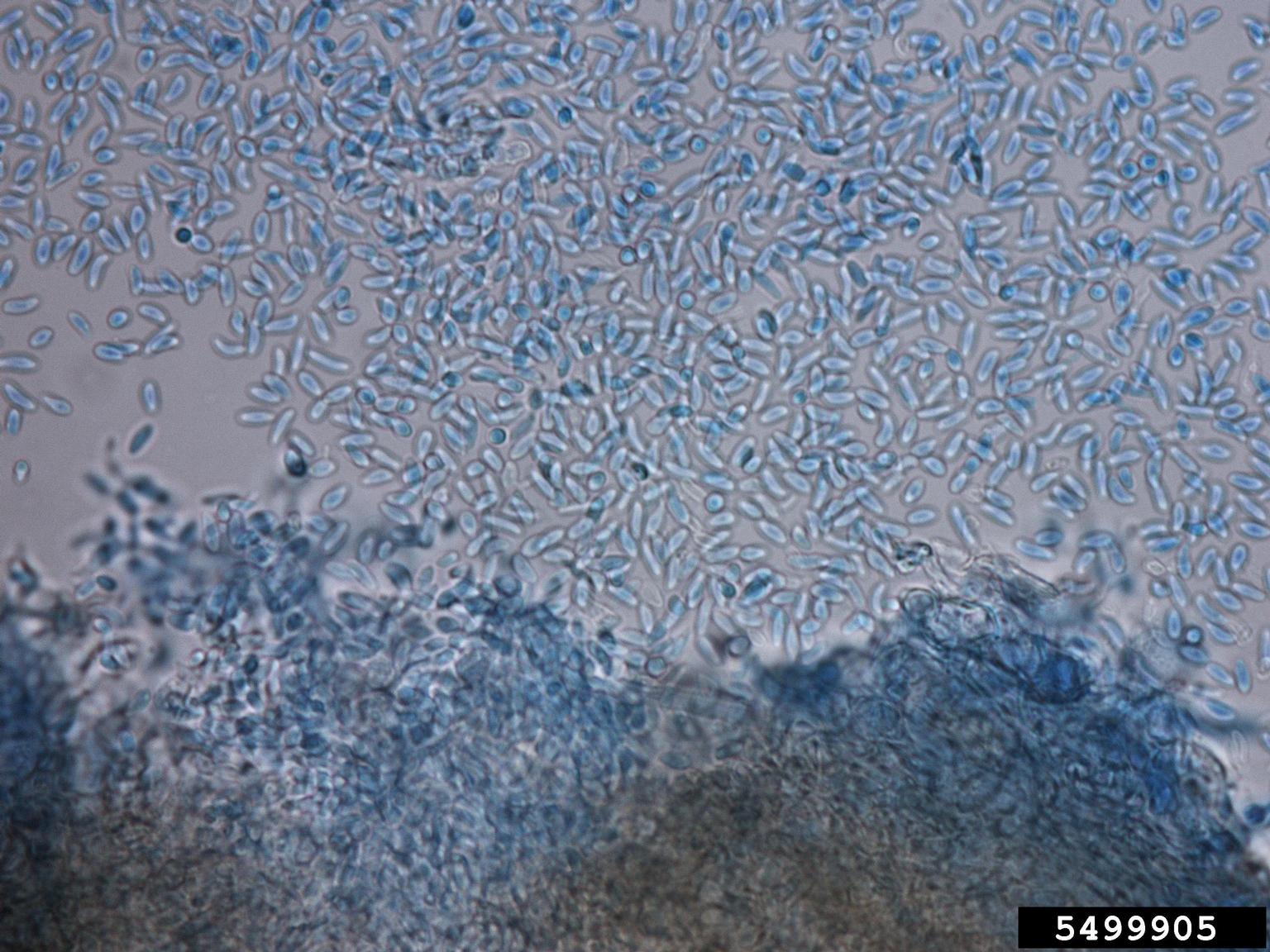Phomopsis cankers and twig blights (Genus Phomopsis (Sacc.) Bubák)