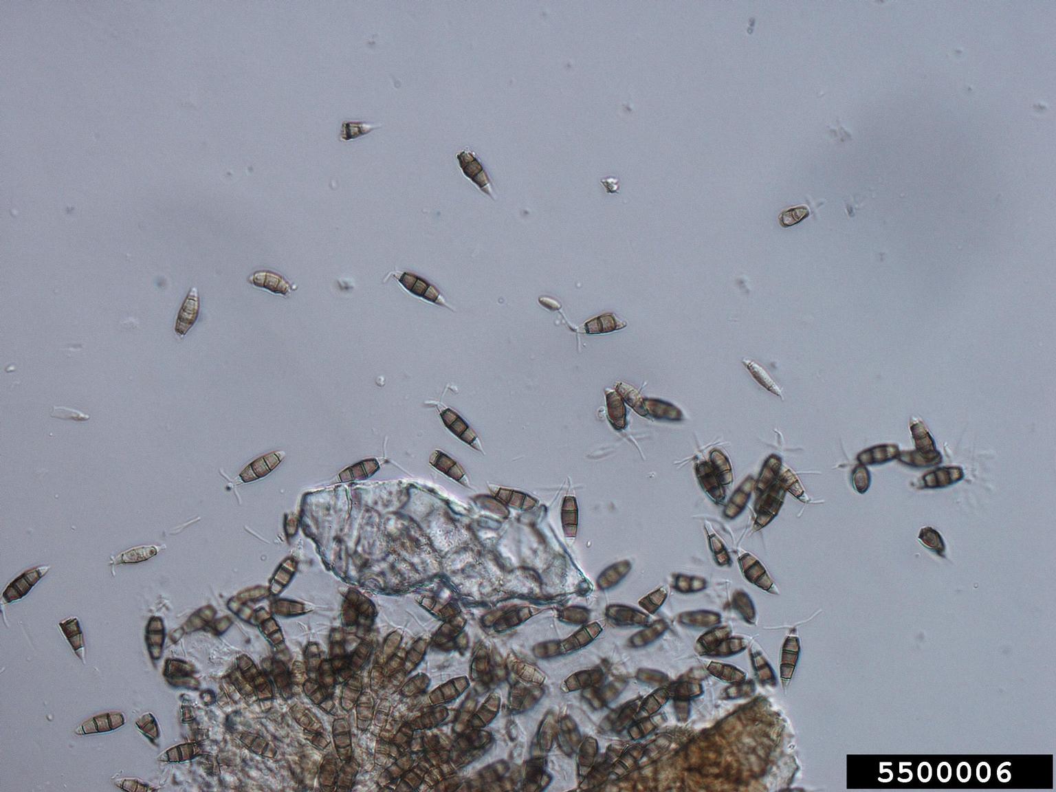 Pestalotiopsis leaf spot (Genus Pestalotiopsis)