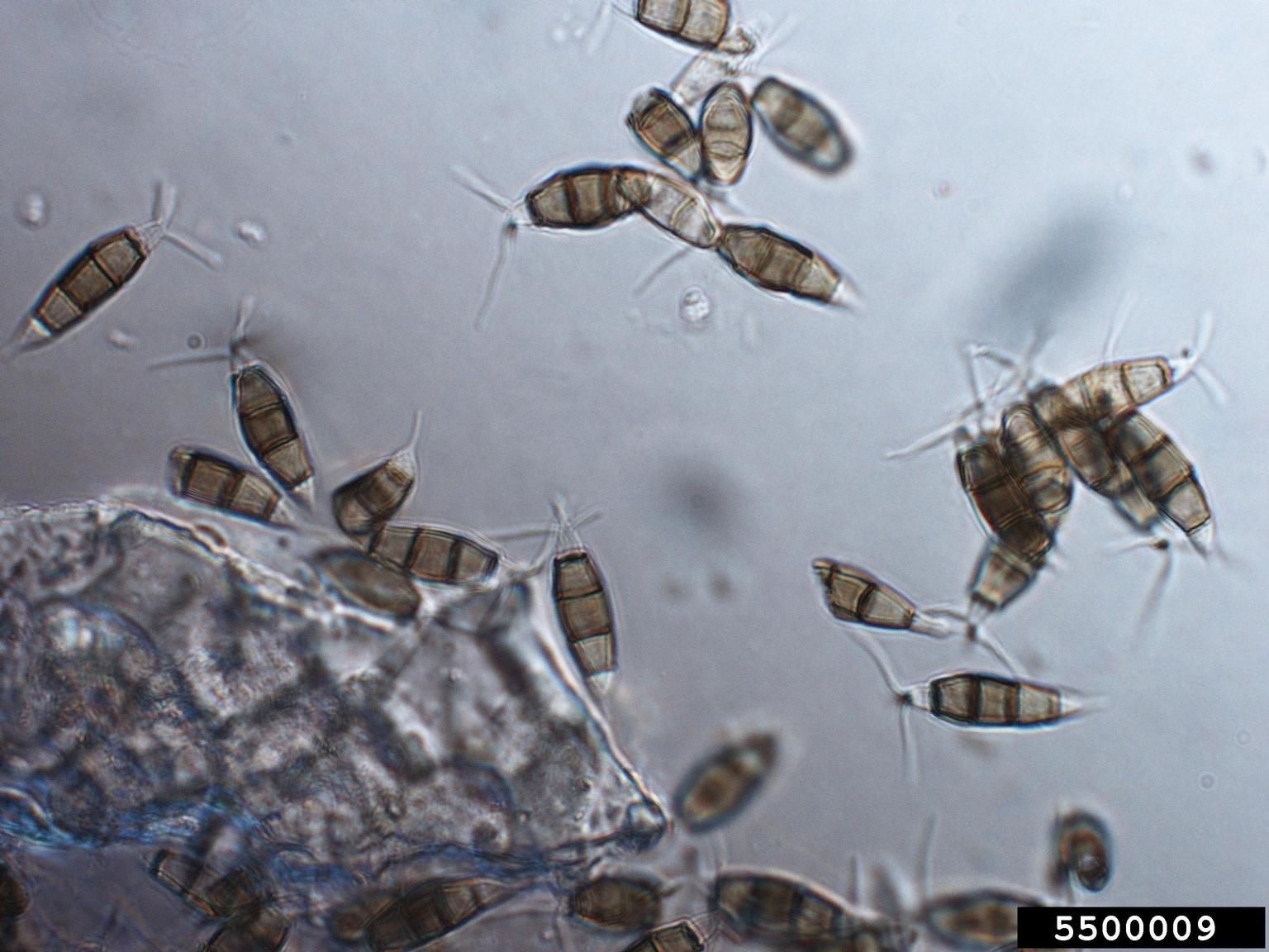 Pestalotiopsis leaf spot (Genus Pestalotiopsis R. L. Steyaert)