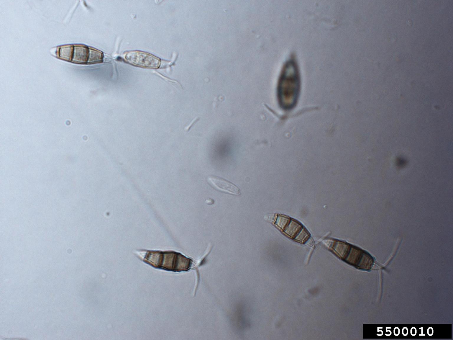 Pestalotiopsis leaf spot (Genus Pestalotiopsis R. L. Steyaert)