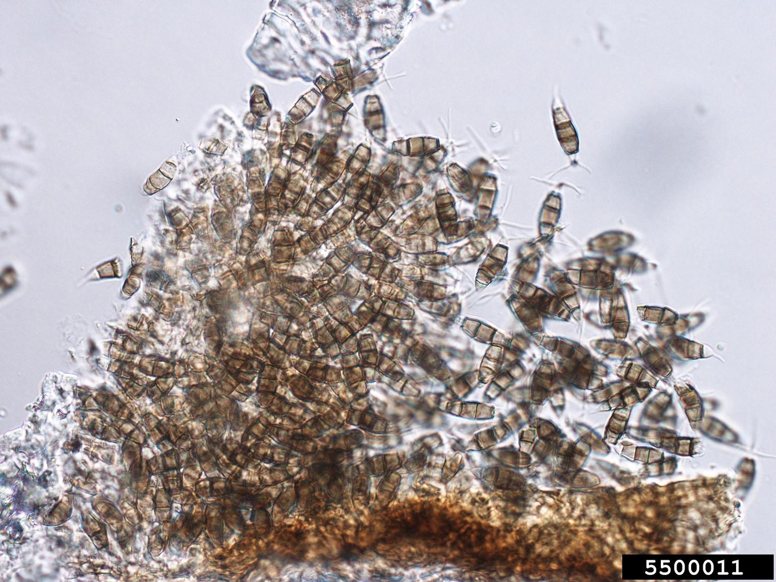 Pestalotiopsis leaf spot (Genus Pestalotiopsis R. L. Steyaert)