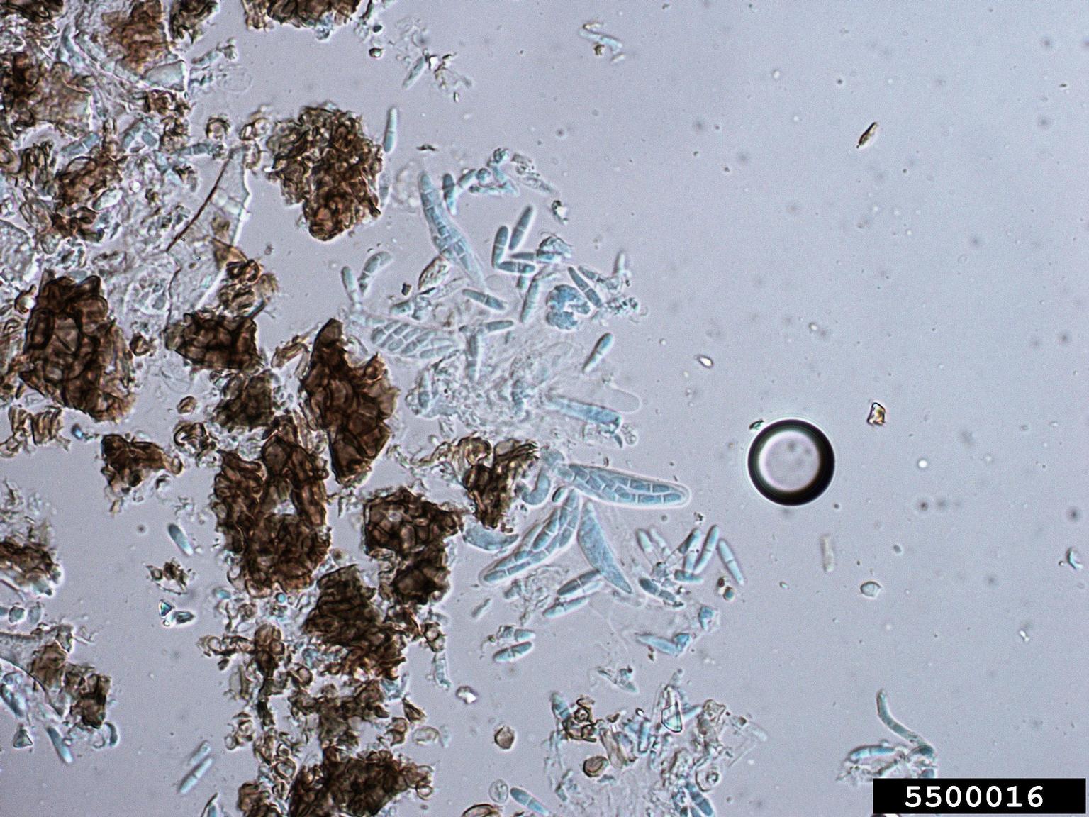 Zasmidium citrigriseum (F.E. Fisher) U. Braun & Crous 2014
