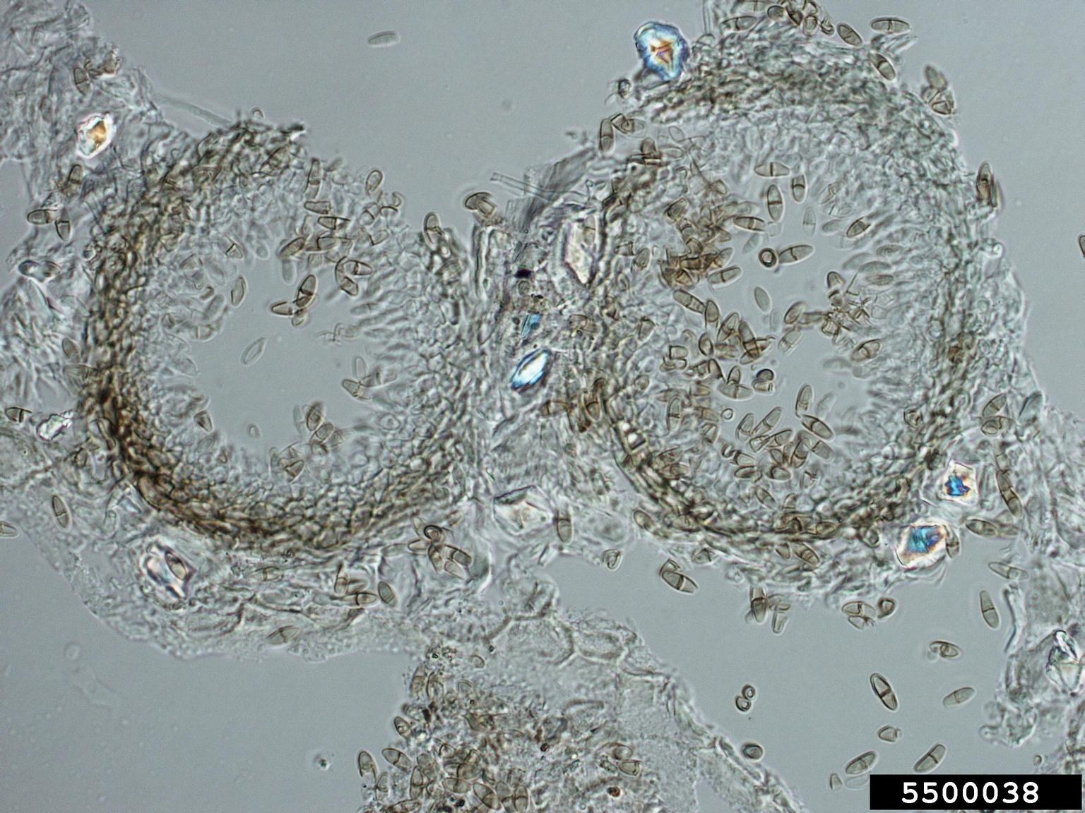 Ascochyta fungi (Genus Ascochyta Lib.)