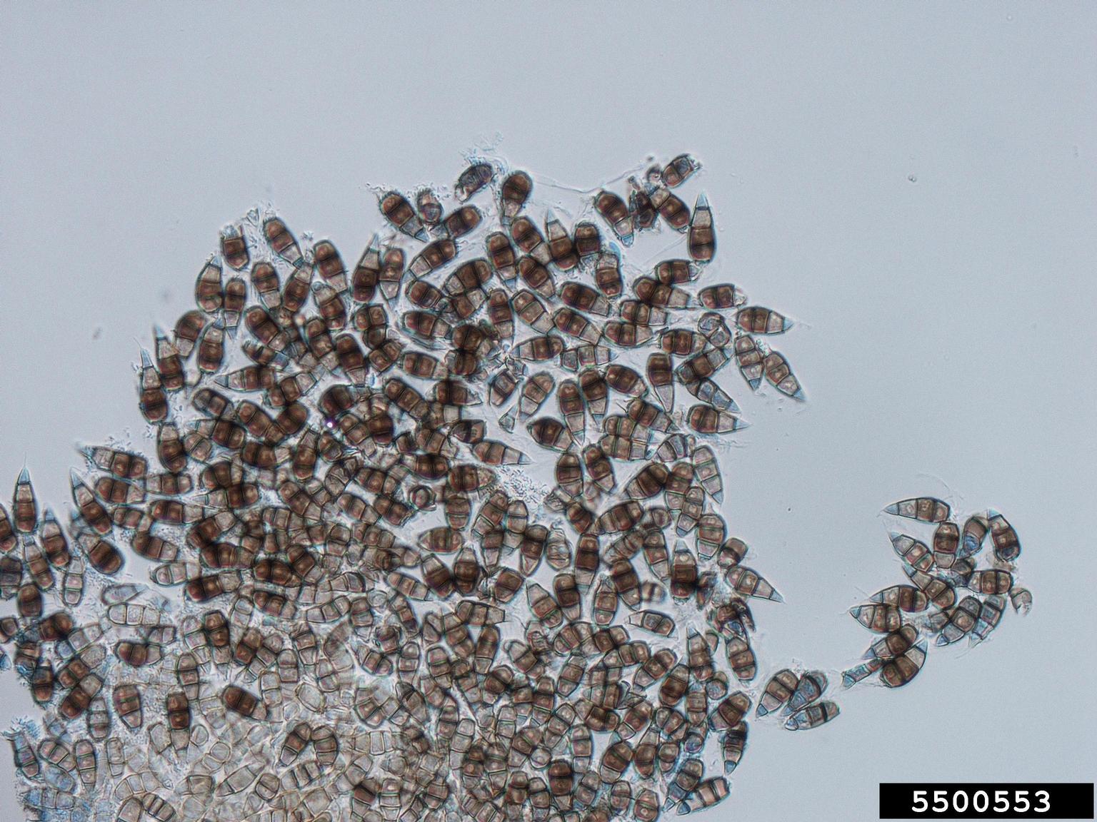 Pestalotiopsis fungus (Pestalotiopsis acaciae (Thüm.) K. Yokoy. & S ...
