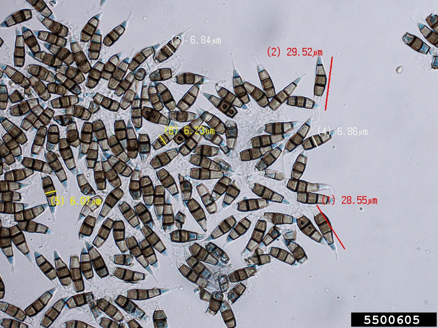 Pestalotiopsis leaf spot (Pestalotiopsis versicolor (Speg.) Steyaert)