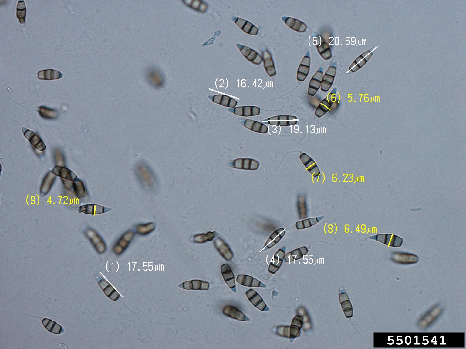Pestalotiopsis blight (Pestalotiopsis guepinii)