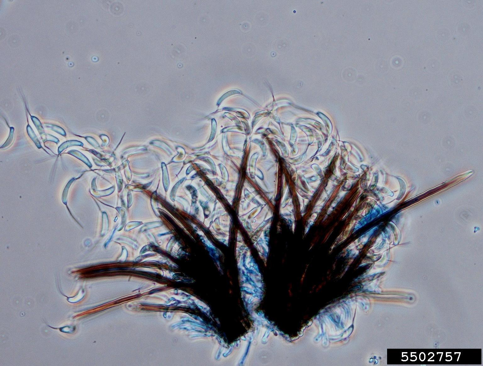 fungus (Annellolacinia dinemasporioides ) on pineapple (Ananas spp ...