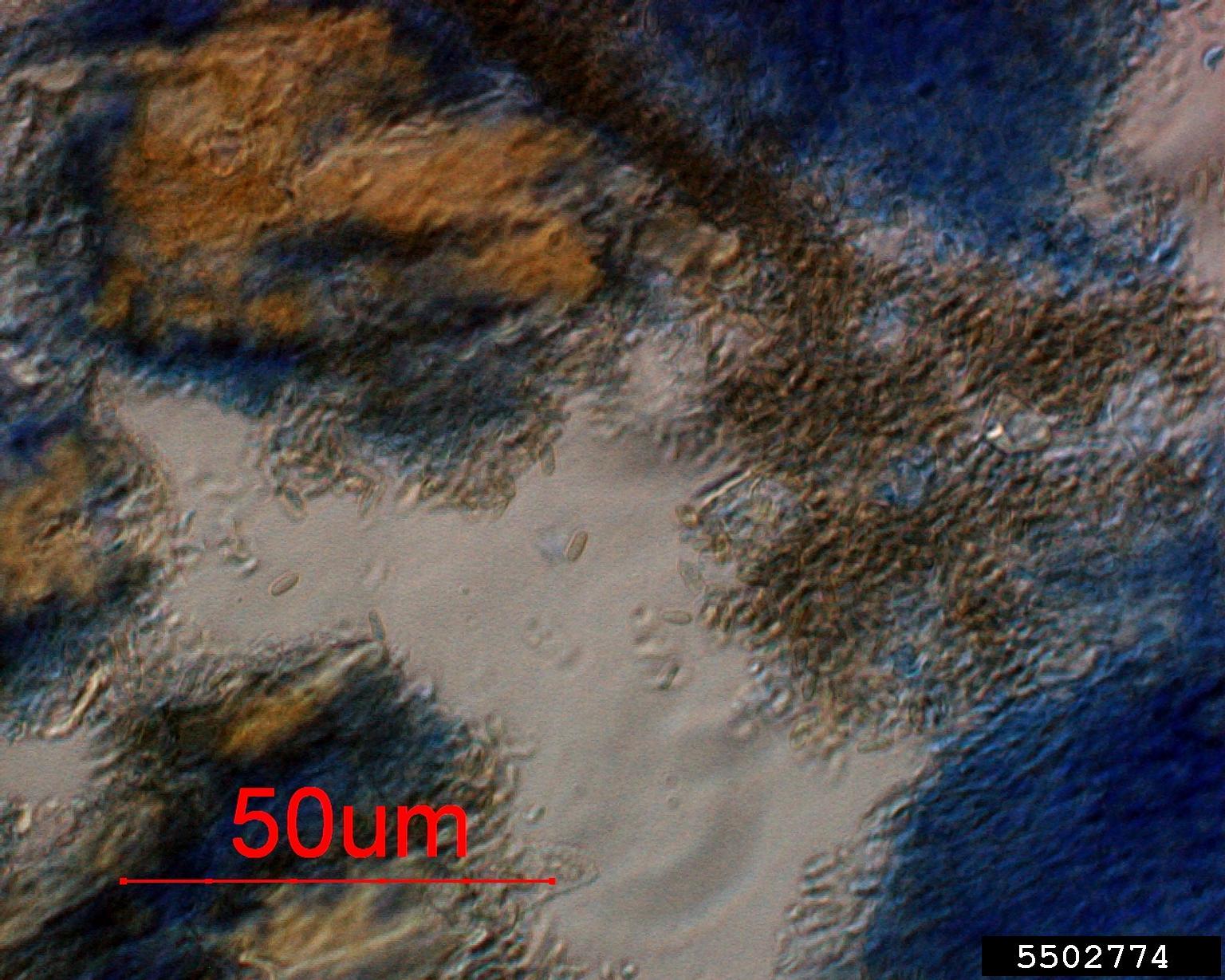 fungus (Genus Microsphaeropsis Höhn., 1917)