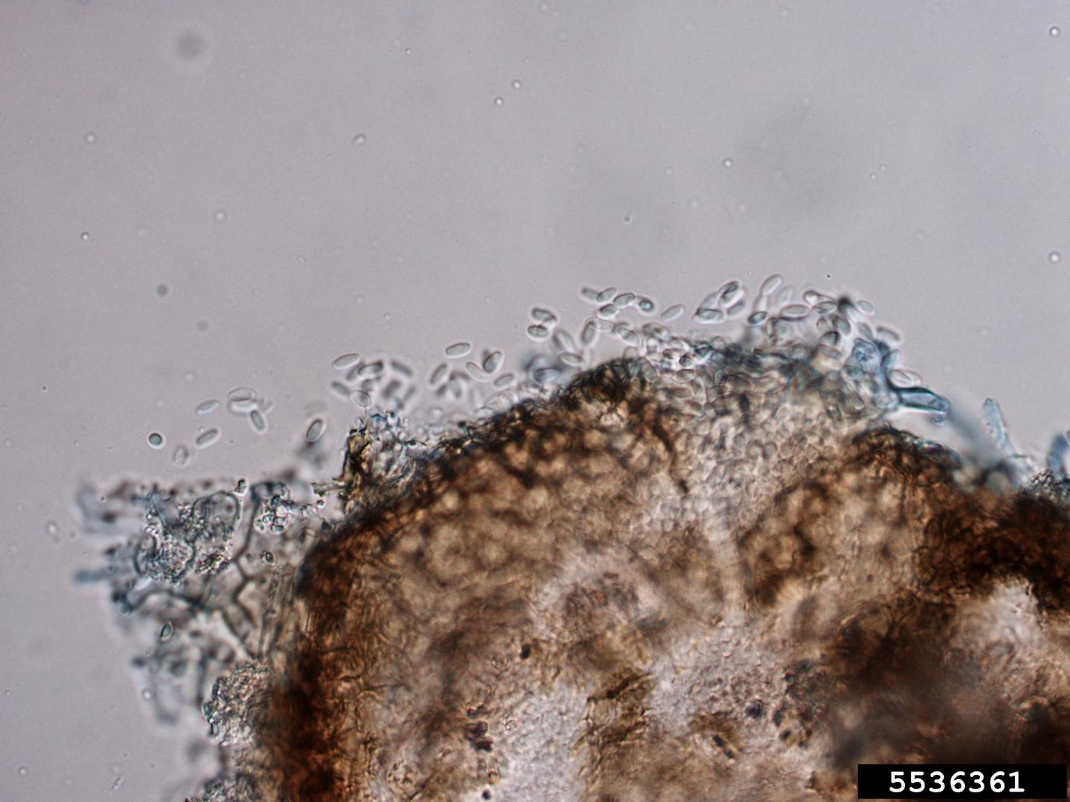 Phoma blights (Genus Phoma Sacc.)
