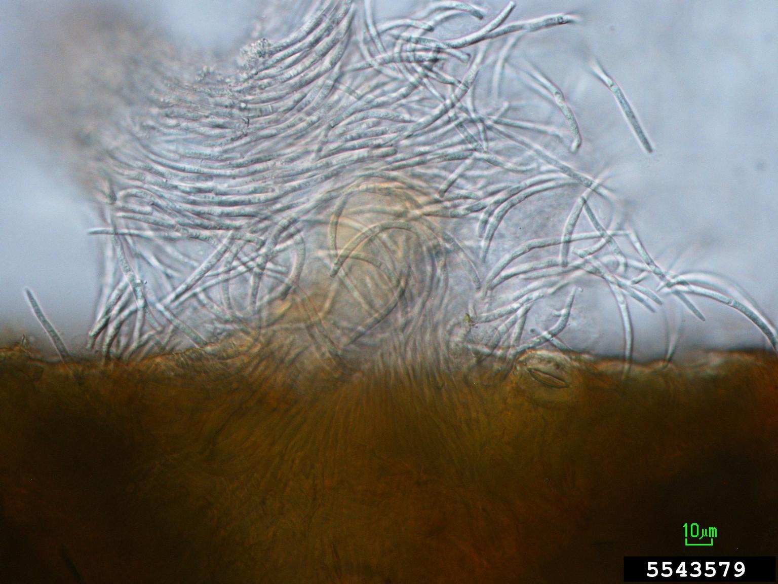 Phloeosporella fungus (Phloeosporella padi (Lib.) Arx)