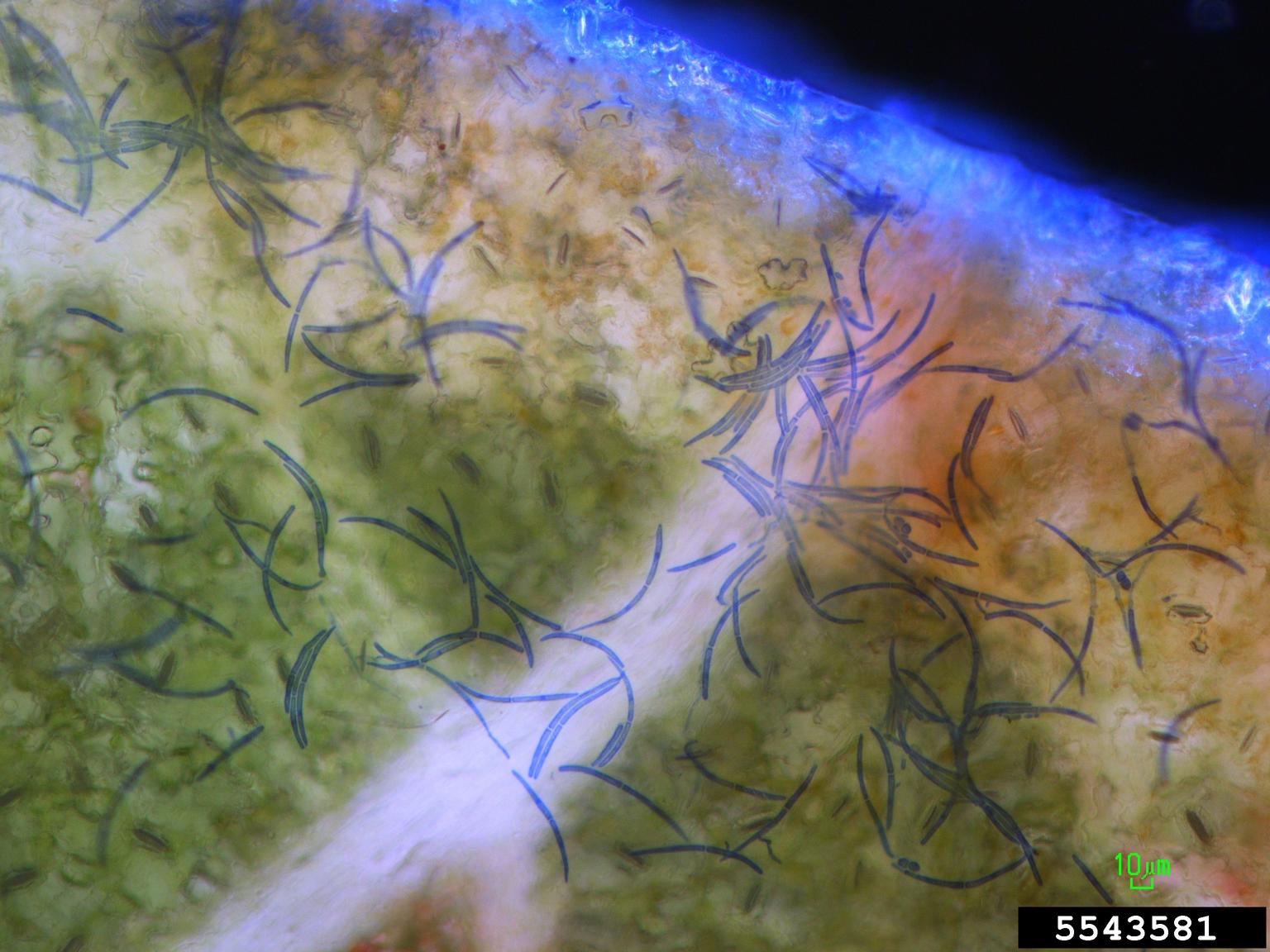 Phloeosporella fungus (Phloeosporella padi (Lib.) Arx)