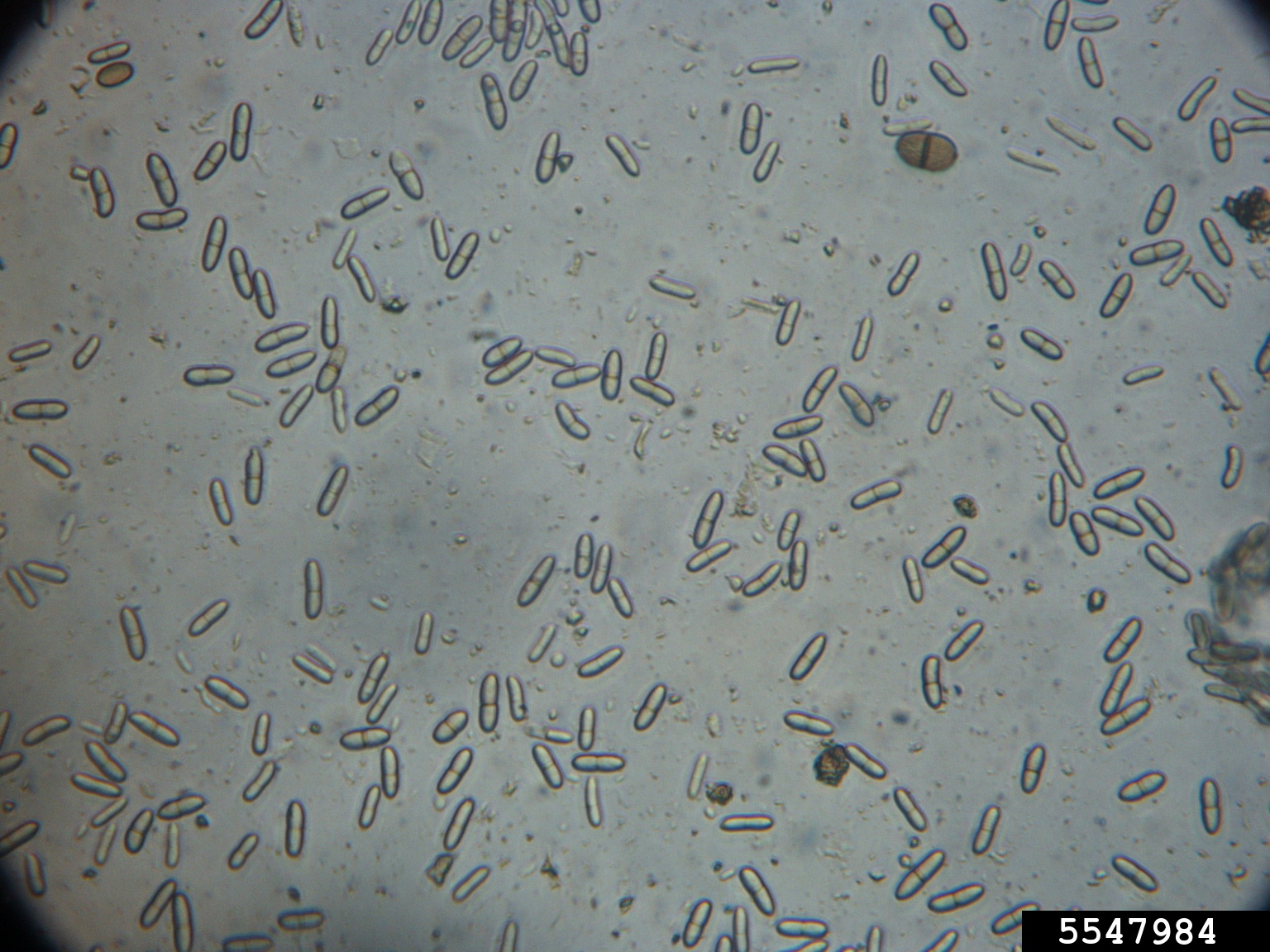 Septoria leaf spot of wheat (Septoria tritici)