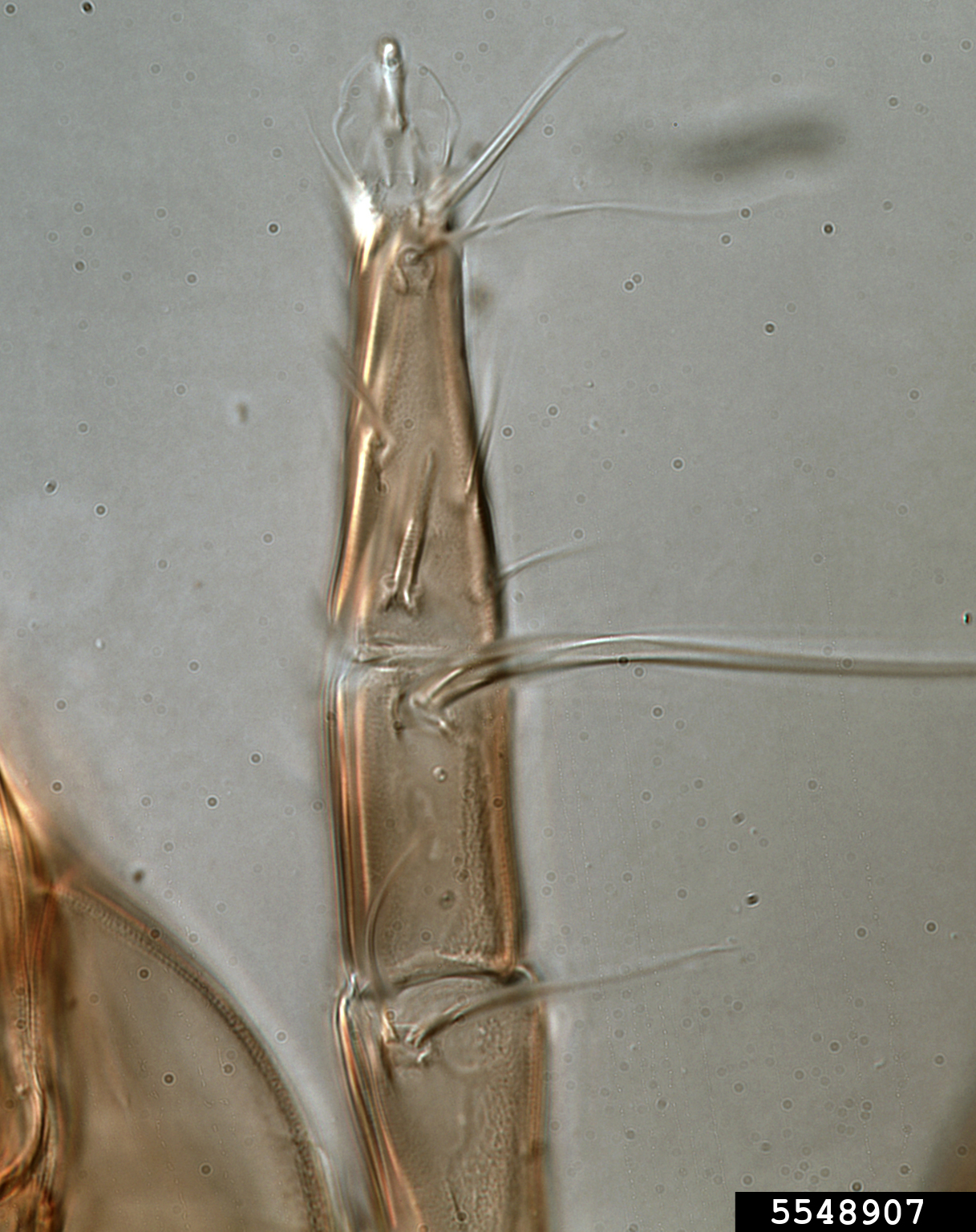 Scaly mite (Suidasia pontifica)