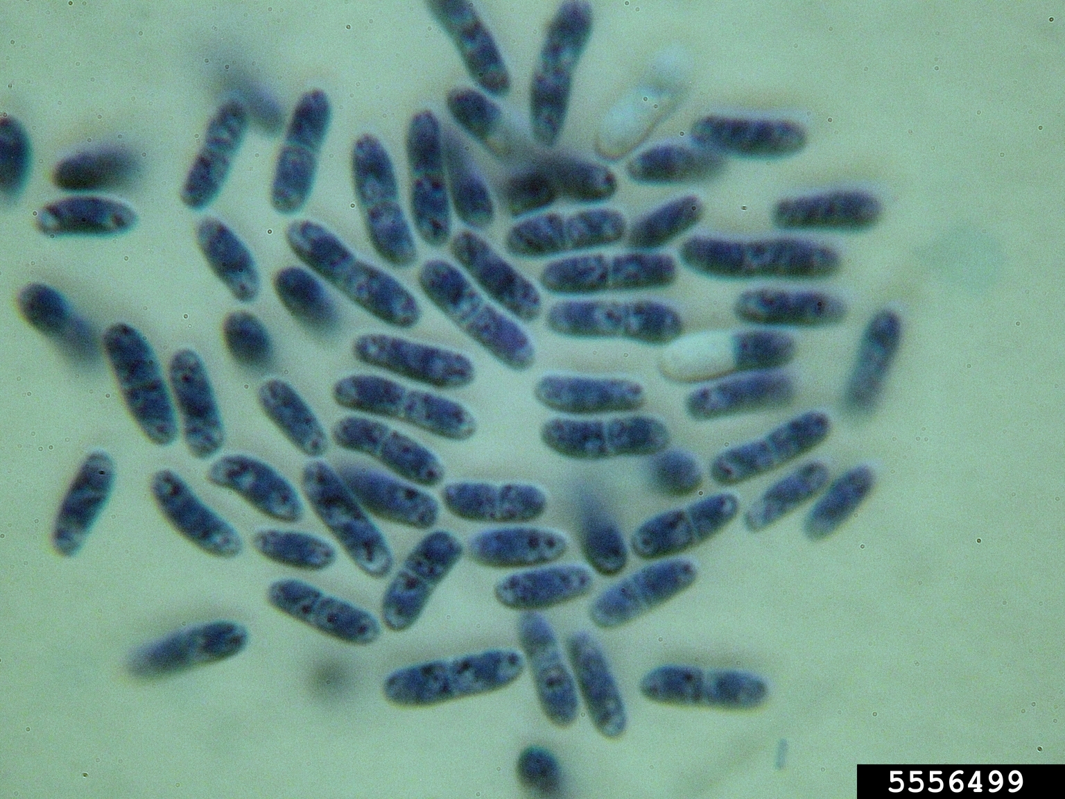 anthracnose (Colletotrichum orbiculare (Berk. & Mont.) Arx)
