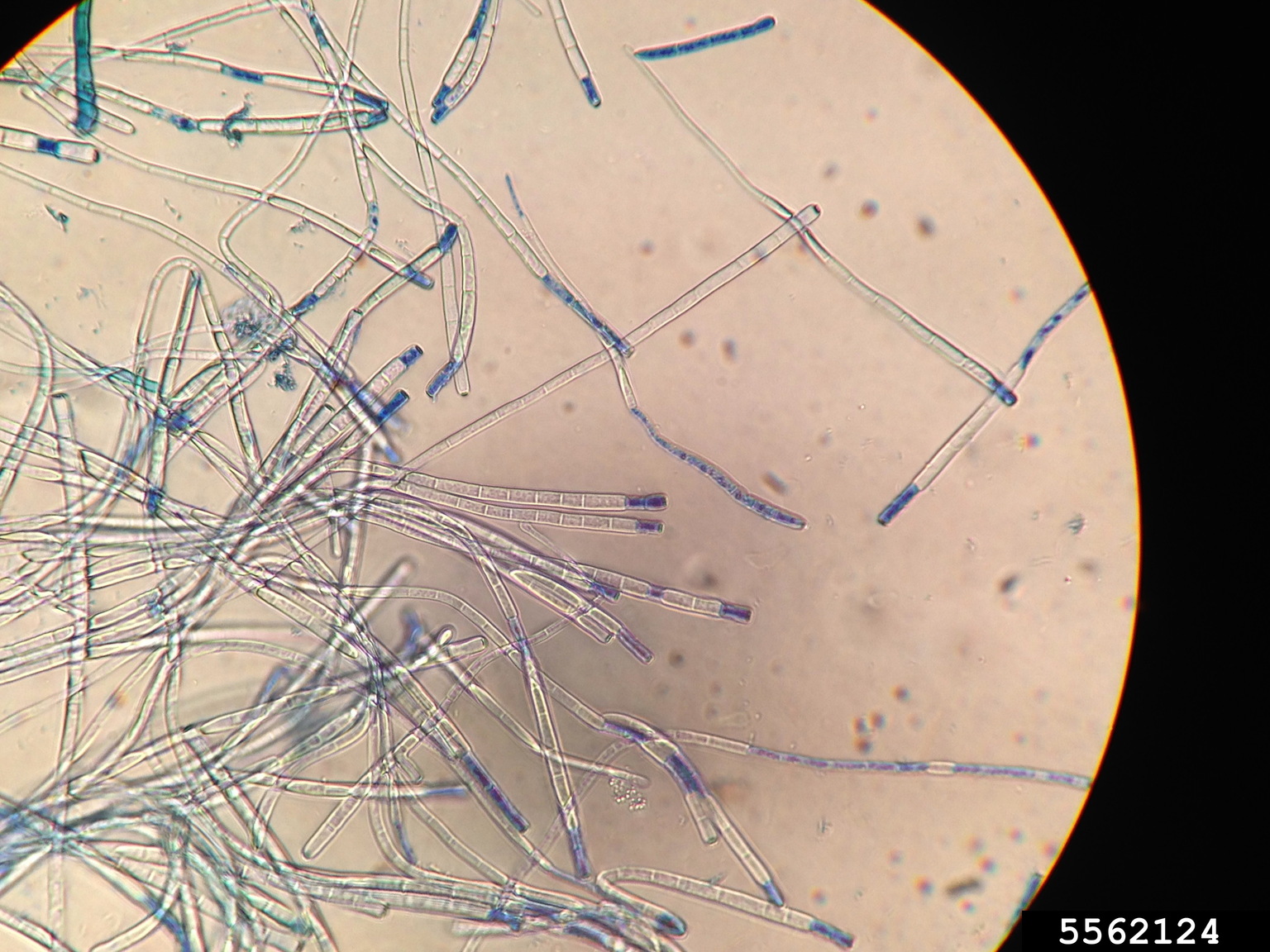 Cercospora fungi (Genus Cercospora Fresen.)