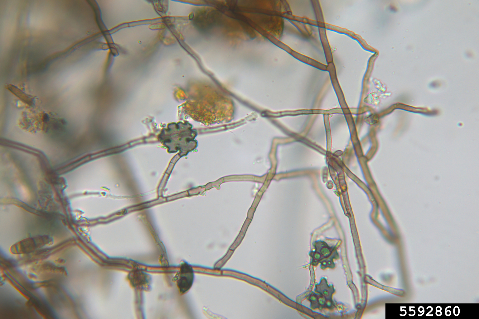 Gaeumannomyces fungi (Genus Gaeumannomyces)