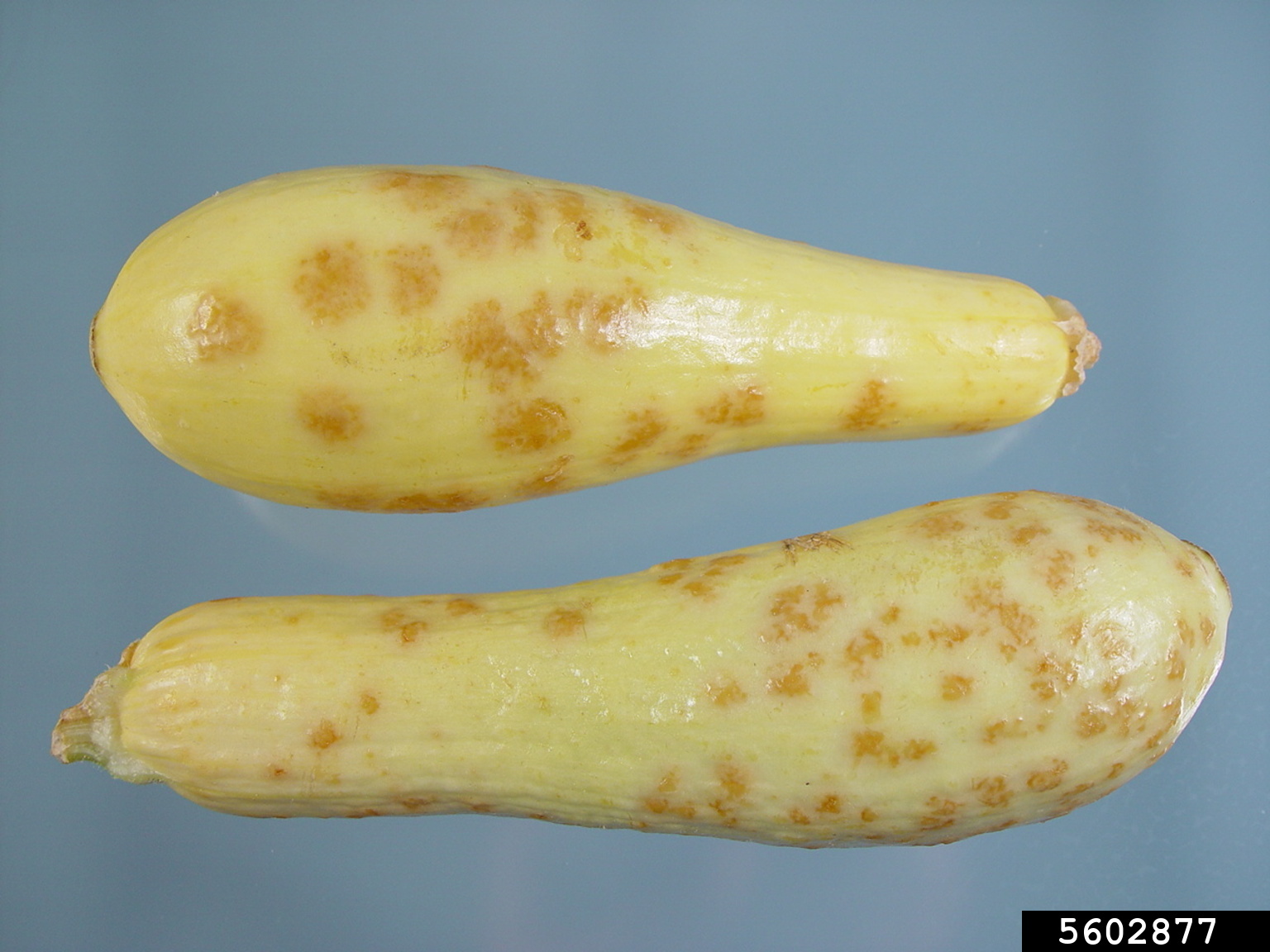 Edema Edema