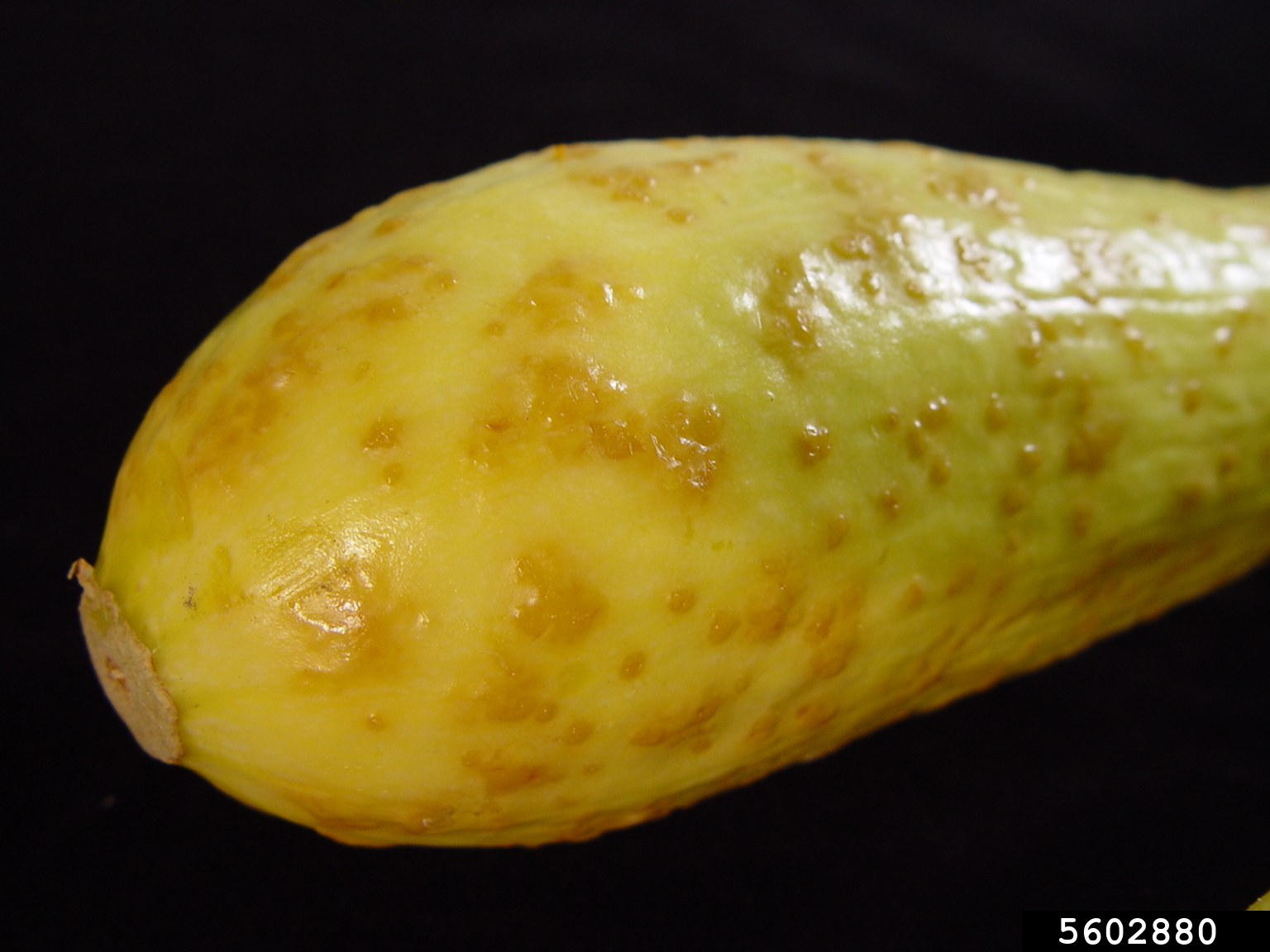 Edema
