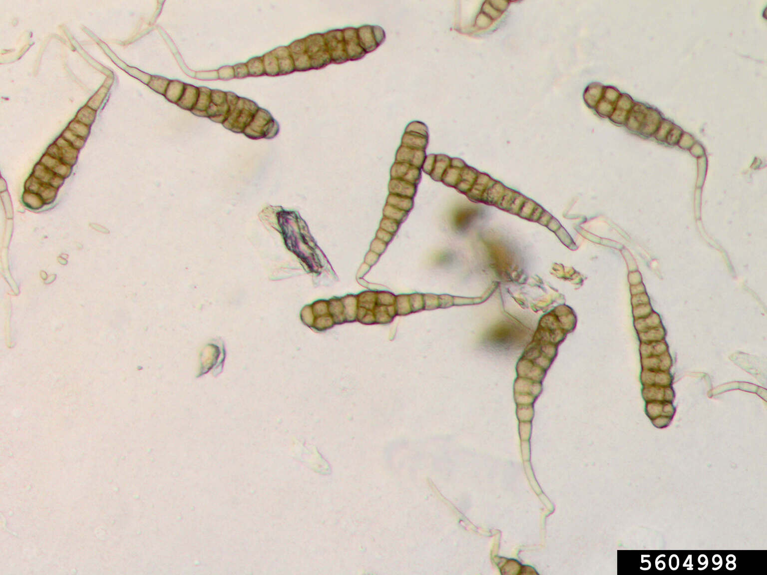 black spot (Alternaria brassicae (Berk.) Sacc.)