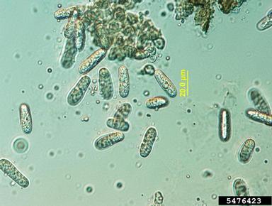 Rhizosphaera needle cast (Rhizosphaera pini ) on fir (Abies spp ...
