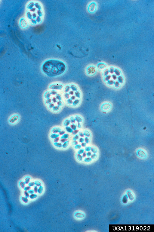microsporidia protozoa (Kneallhazia solenopsae (J.D. Knell, G.E. Allen ...