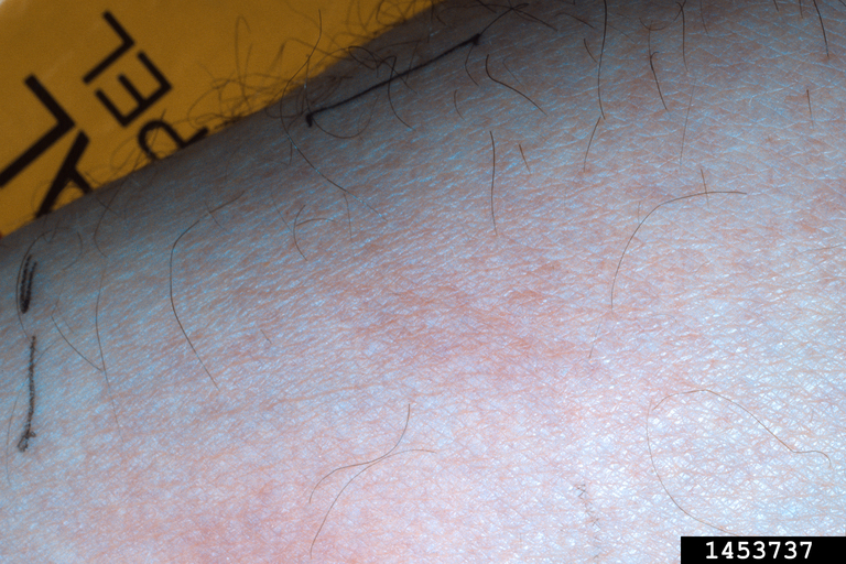 puss caterpillar (Megalopyge opercularis)