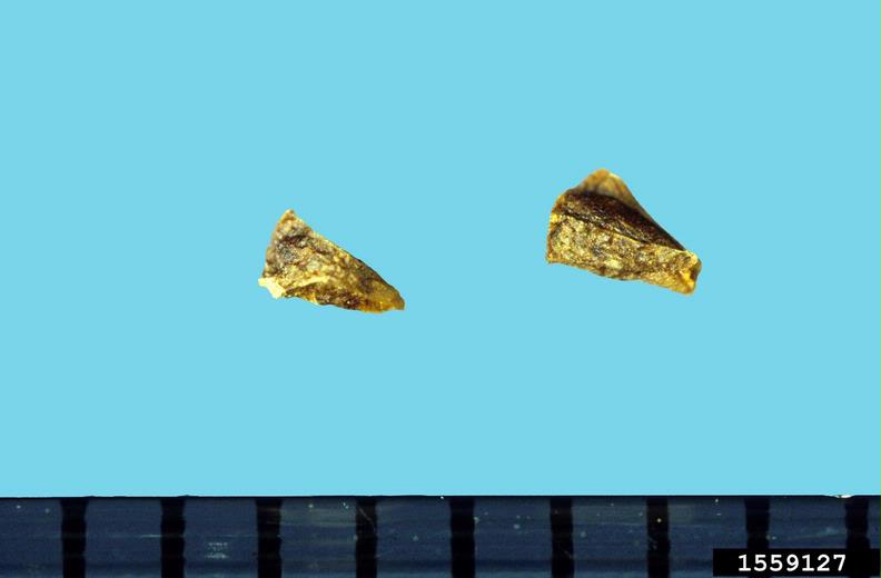 slender rush (Juncus tenuis Willd.)