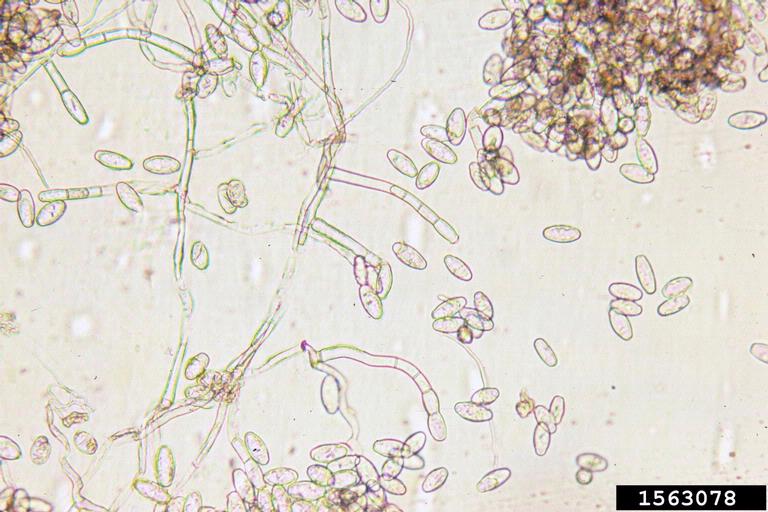 powdery mildew (Podosphaera fuliginea (Schltdl.) U. Braun & S. Takam.)