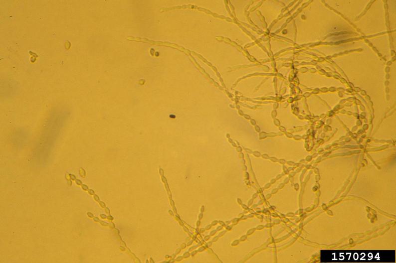brown rot (Monilinia fructicola (G. Wint.) Honey)