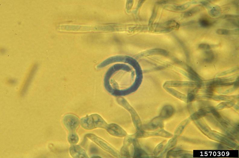 fungus (Genus Helicoma)