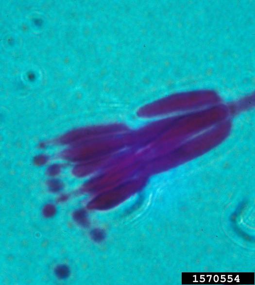 Penicillium fungus (Penicillium dendriticum)