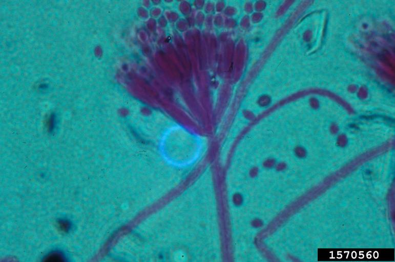 Penicillium fungus (Penicillium dendriticum)