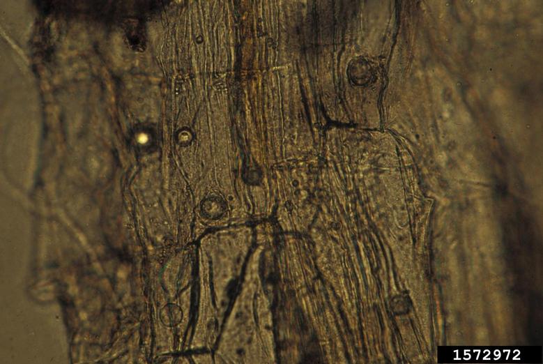 Pythium diseases (Genus Pythium Pringsh.)