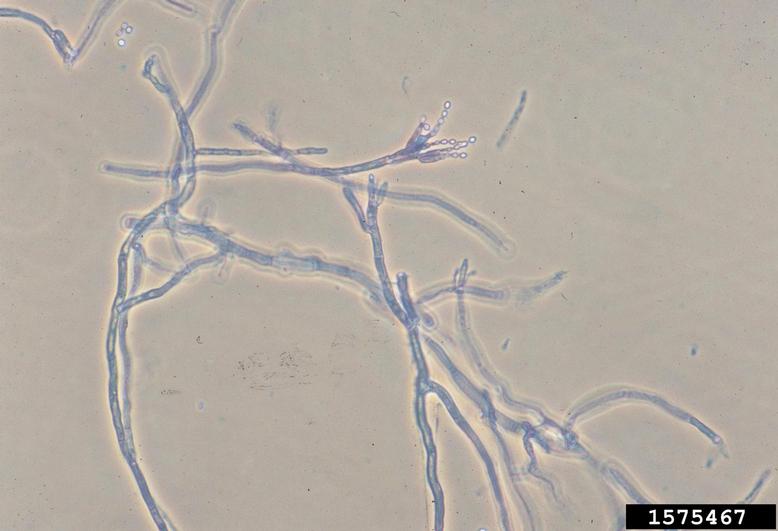 Penicillium fungi (Genus Penicillium)