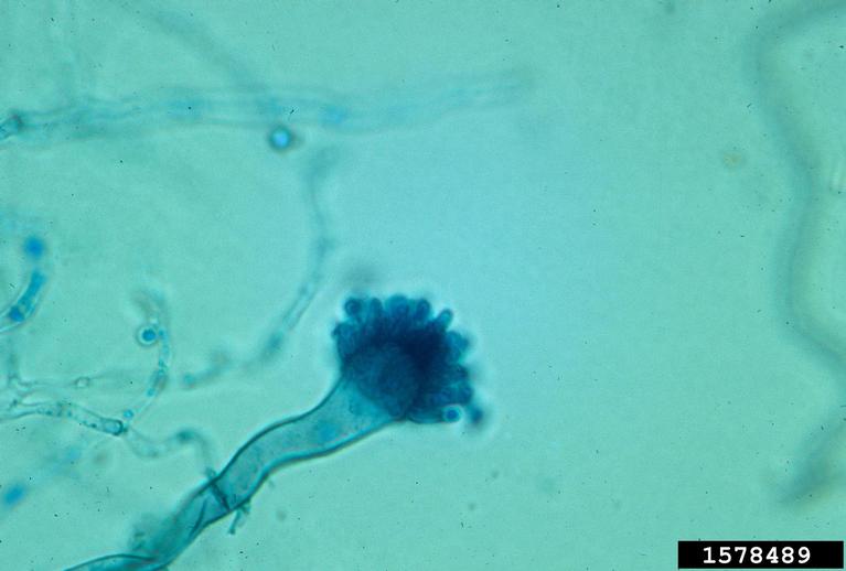 Aspergillus fungi (Genus Aspergillus Link)