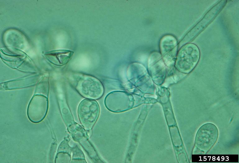 nematode-trapping fungus, Arthrobotrys spp. (Orbiliales: Orbiliaceae ...
