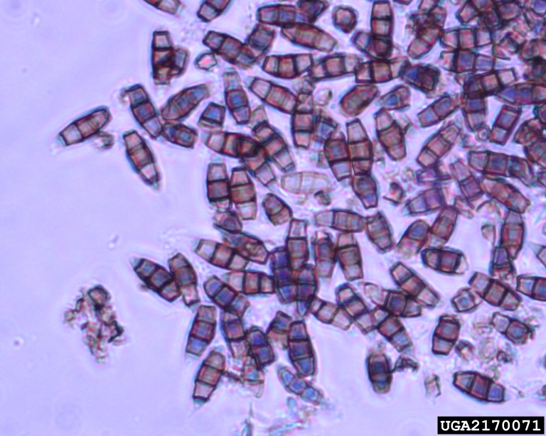 Pestalotiopsis leaf spot (Pestalotiopsis palmarum (Cooke) Steyaert)