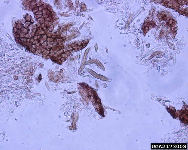 Phaeosphaeria fungi (Genus Phaeosphaeria I. Miyake)