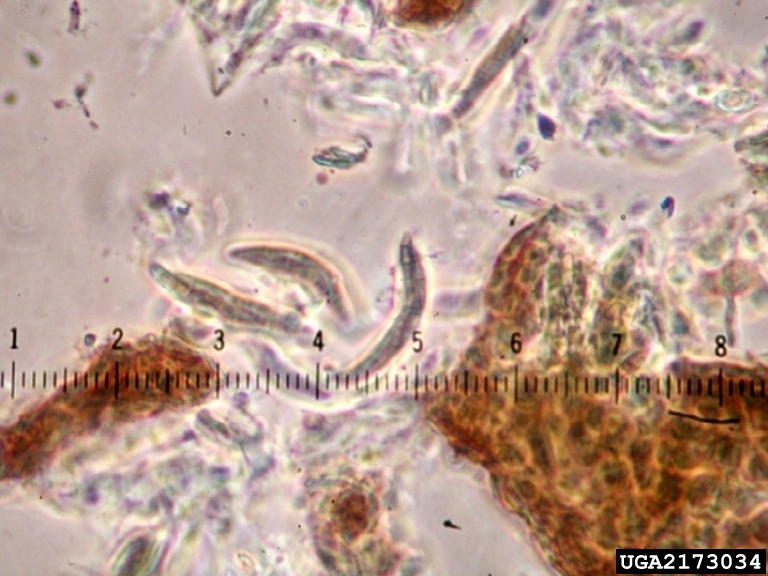 Phaeosphaeria fungi (Genus Phaeosphaeria I. Miyake)